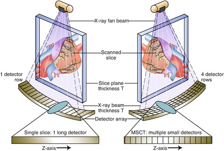 Basic Principles in Computed Tomography (CT) | SpringerLink
