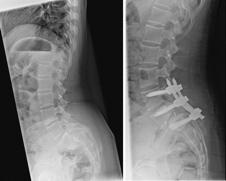 Paediatric Spine | SpringerLink