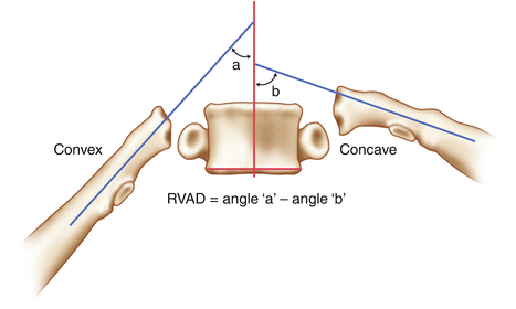 Paediatric Spine | SpringerLink