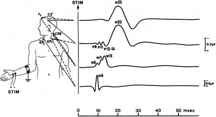 Somatosensory Evoked Potentials | SpringerLink