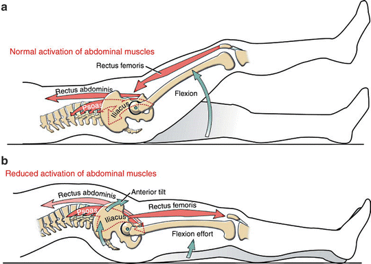 Fundamental and Clinical Considerations of the Muscles of the Hip ...
