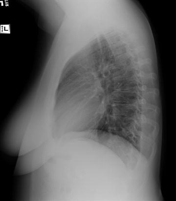 Lateral Chest | SpringerLink