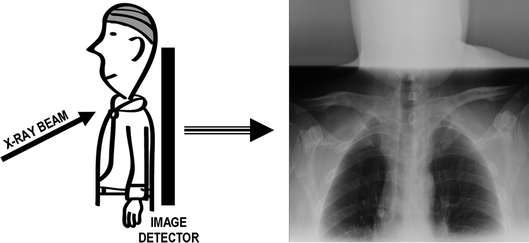 Conventional Radiology | SpringerLink