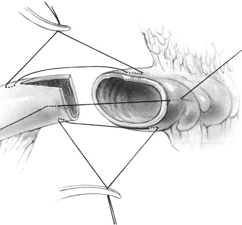 Dissecting and Suturing | SpringerLink