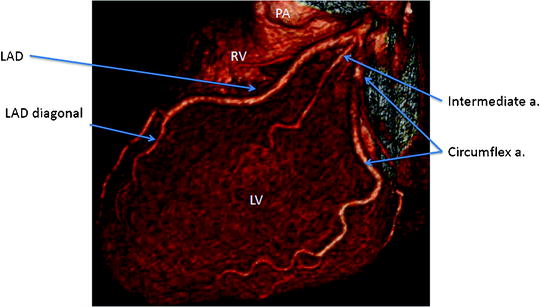 Anatomy of Coronary Vessels | SpringerLink