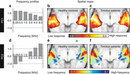 Mapping Tonotopy in Human Auditory Cortex | SpringerLink