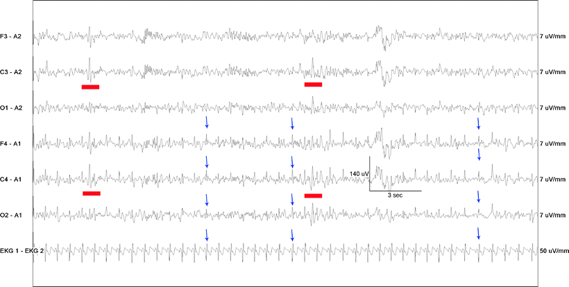 Artifacts | SpringerLink