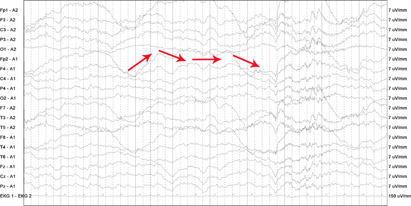 Artifacts | SpringerLink