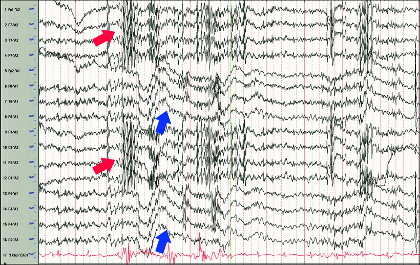 Artifacts | SpringerLink