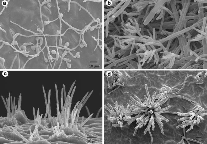 Scanning Electron Microscopy for Fungal Sample Examination | SpringerLink