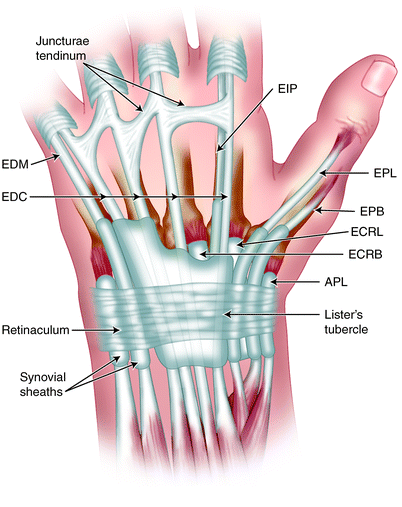 Surgical Options for the Failed Wrist Arthrodesis | SpringerLink