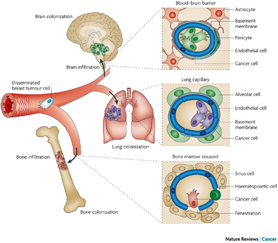Hematogenous Dissemination | SpringerLink