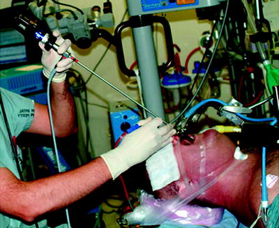 Phonomicrosurgery and Office-Based Laryngology | SpringerLink