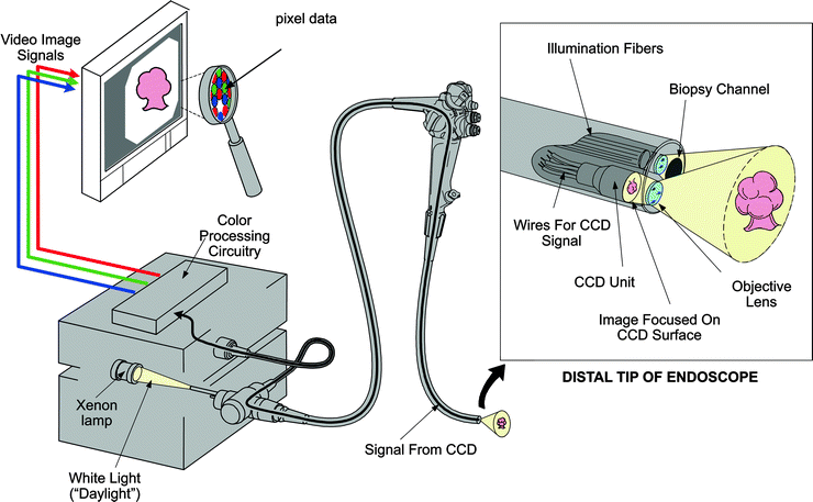 General Principles of Endoscopic Imaging | SpringerLink
