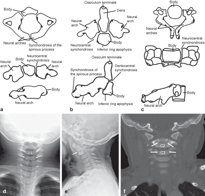 Anatomy and Development of the Young Spine | SpringerLink