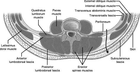 Challenging Hernia Locations: Flank Hernias | SpringerLink