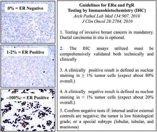 Molecular Pathology of Breast Cancer | SpringerLink