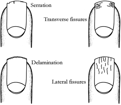 Nanotechnology in Nail Care | SpringerLink