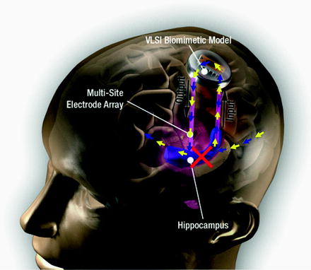Reverse Engineering the Brain: A Hippocampal Cognitive Prosthesis for ...