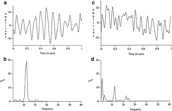 EEG Signal Processing: Theory and Applications | SpringerLink