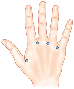 The Extra Acupuncture Points 奇穴 | SpringerLink