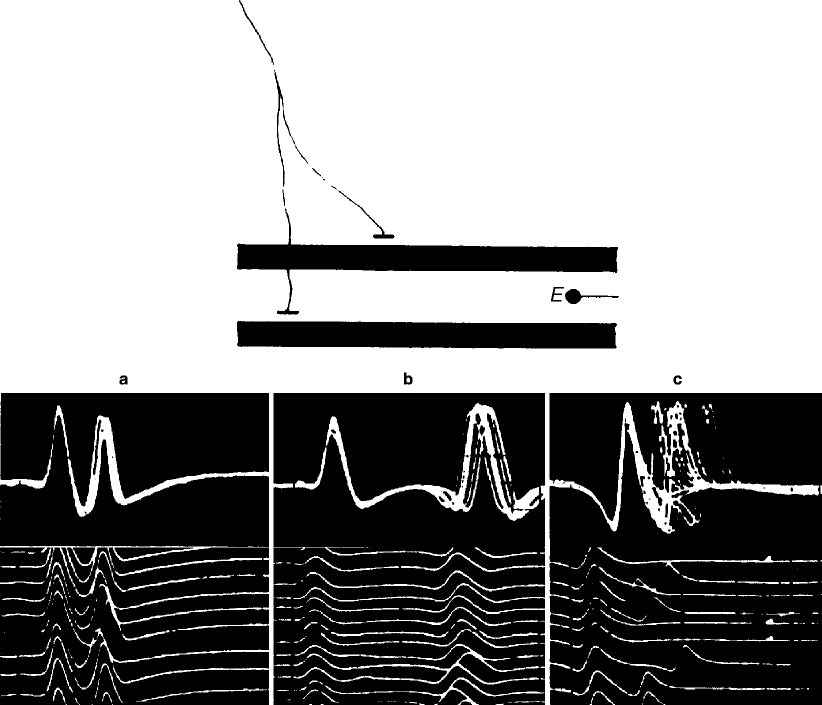 Single-Fiber EMG | SpringerLink