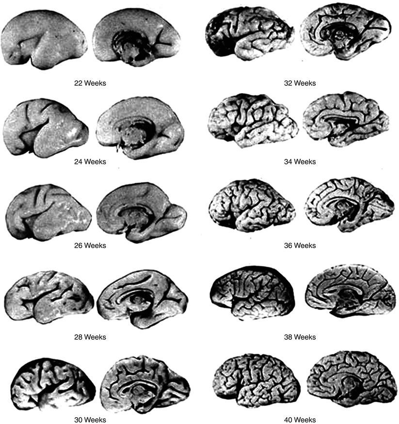 Pediatric Autopsy: Fetus, Newborn, and Child | SpringerLink