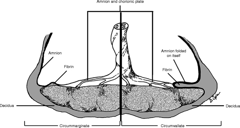 The Placenta | SpringerLink