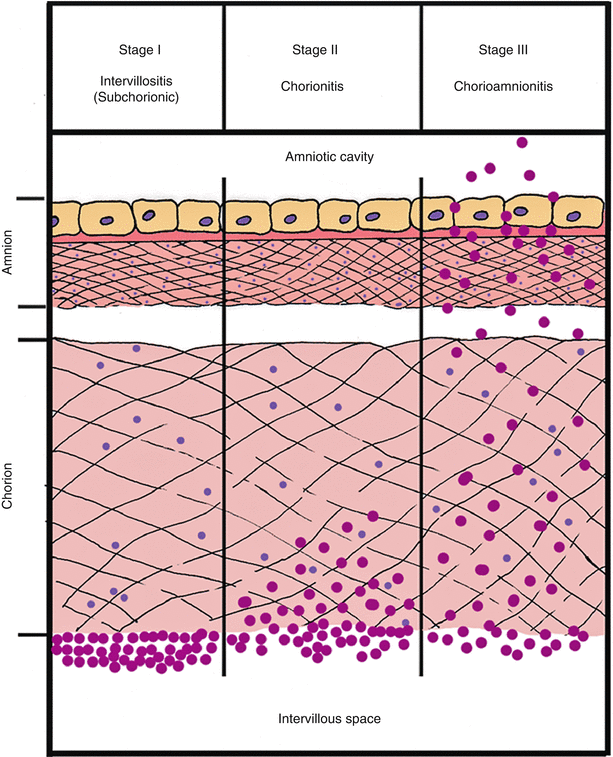 The Placenta | SpringerLink
