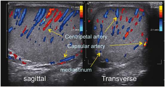 Embryology Relevant to Ultrasound Imaging of the Male Genitalia ...