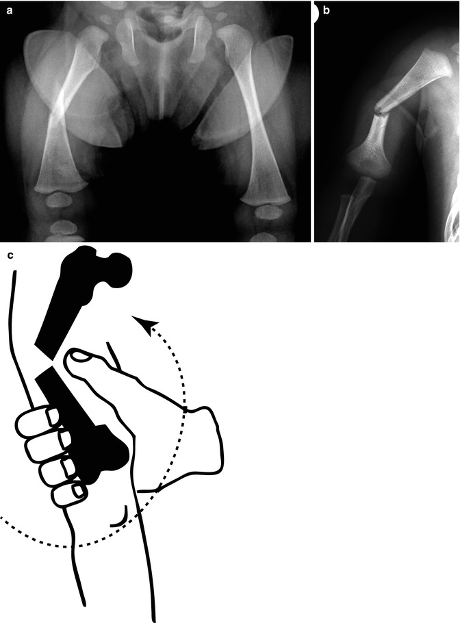 Battered Child Syndrome/Non-accidental Trauma | SpringerLink