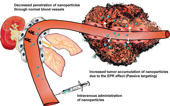 The EPR Effect in Cancer Therapy | SpringerLink