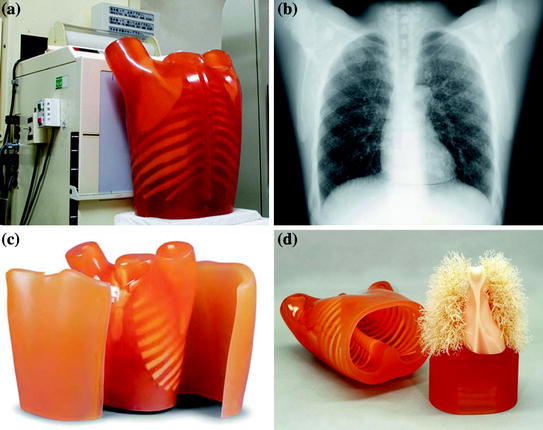 Imaging Phantoms: Conventional X-ray Imaging Applications | SpringerLink