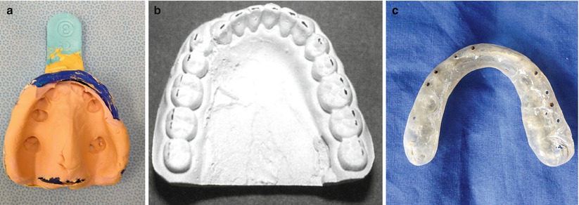 Impressions, Models, and Splints: The Basic Maxillofacial Laboratory ...