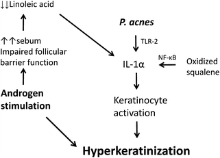 Acne Pathophysiology | SpringerLink