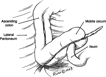 Colon and Anorectum | SpringerLink