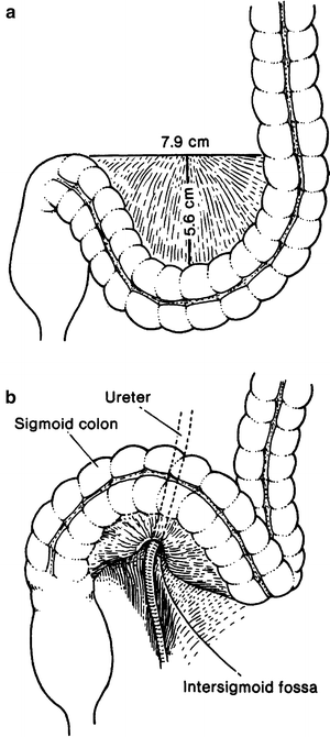 Colon and Anorectum | SpringerLink