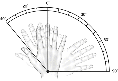 Physical Examination of the Hand | SpringerLink
