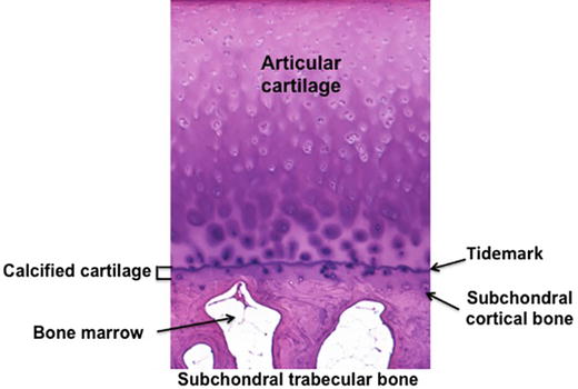 The Response of the Subchondral Bone to Injury | SpringerLink