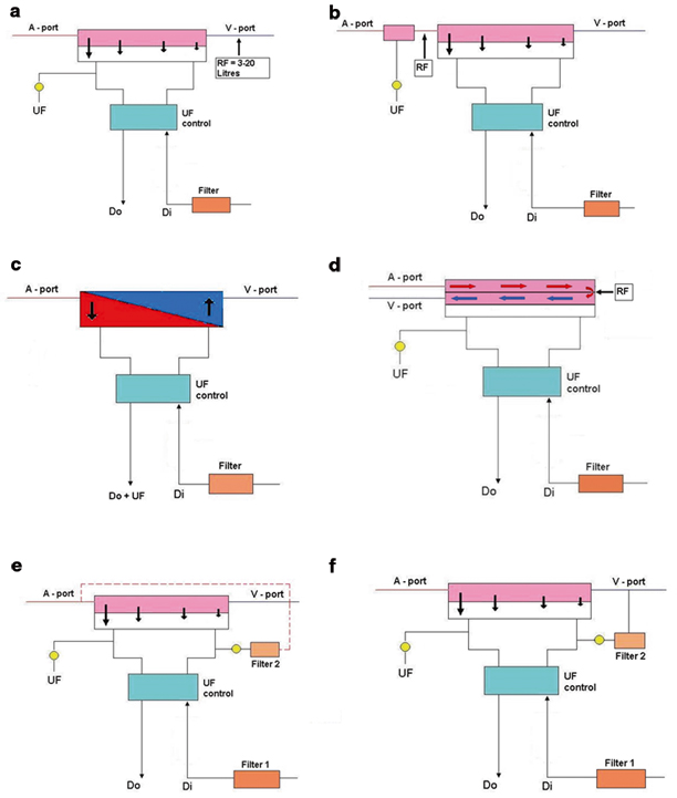 Hemodiafiltration | SpringerLink