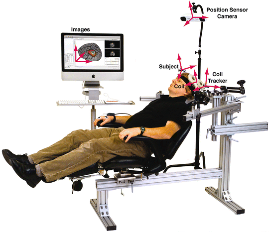 Neuronavigation for Transcranial Magnetic Stimulation | SpringerLink
