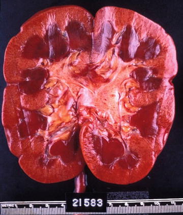 Gross Examination | SpringerLink