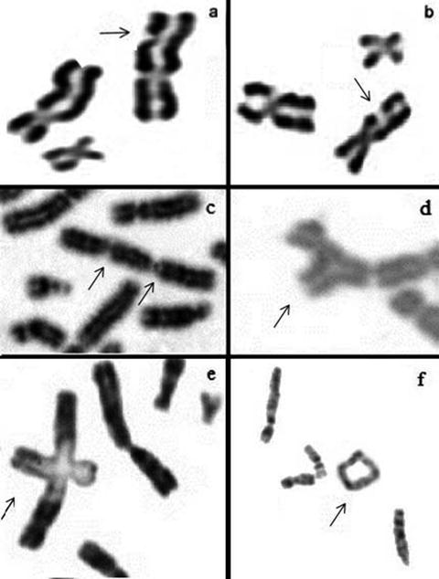 Chromosomal Aberration Test Utilities In Vitro and In Vivo | SpringerLink
