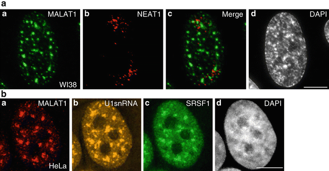 RNA Fluorescence In Situ Hybridization in Cultured Mammalian Cells ...