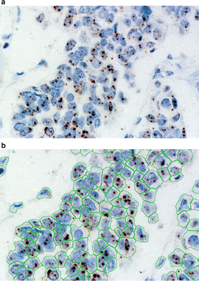 Quantitative Ultrasensitive Bright-Field RNA In Situ Hybridization with ...