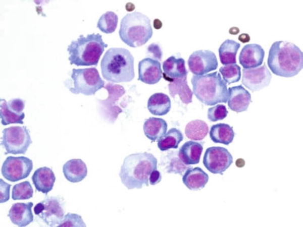 Cerebrospinal Fluid (CSF) Cytology | SpringerLink
