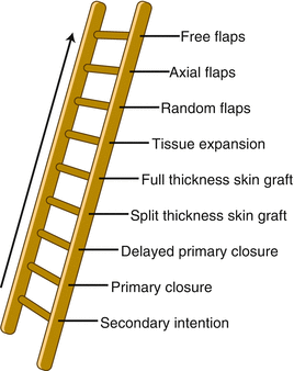 Defect Closure After Lesion Excision of the Face | SpringerLink
