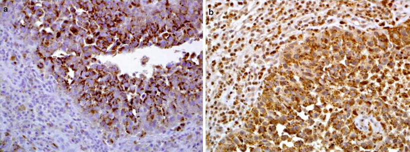 Rabbit Monoclonal Antibodies | SpringerLink