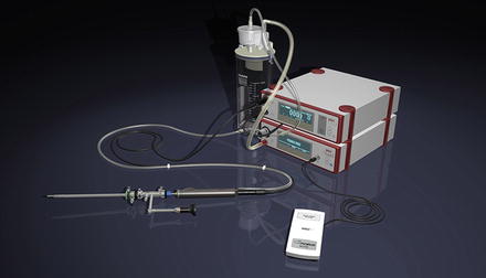 Holmium Enucleation of Prostate | SpringerLink