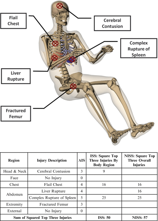 Automotive Field Data in Injury Biomechanics | SpringerLink